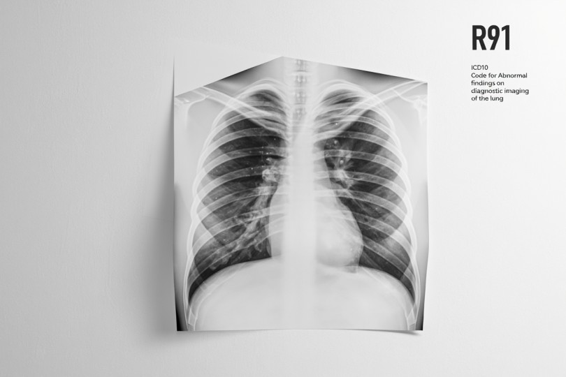 R91: ICD10 Code for Abnormal findings on diagnostic imaging of the lung
