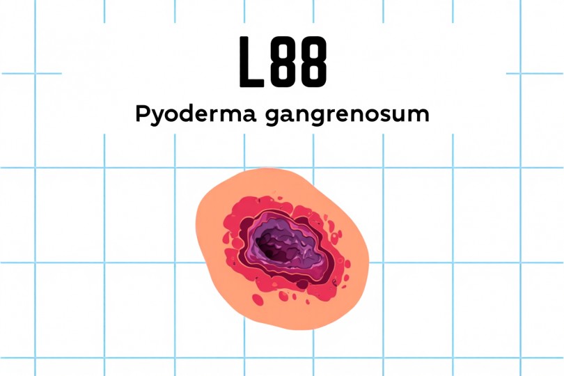 L88: ICD10 Code for Pyoderma gangrenosum