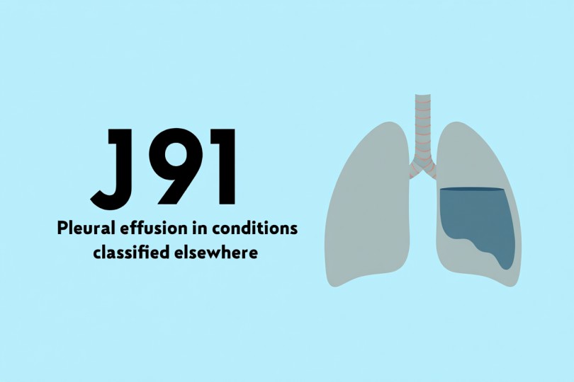 J91: ICD10 Code for Pleural effusion in conditions classified elsewhere