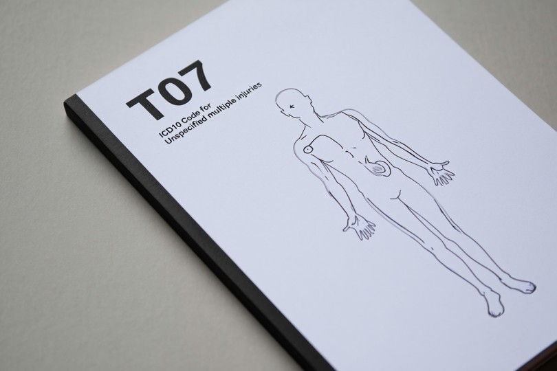 T07: ICD10 Code for Unspecified multiple injuries