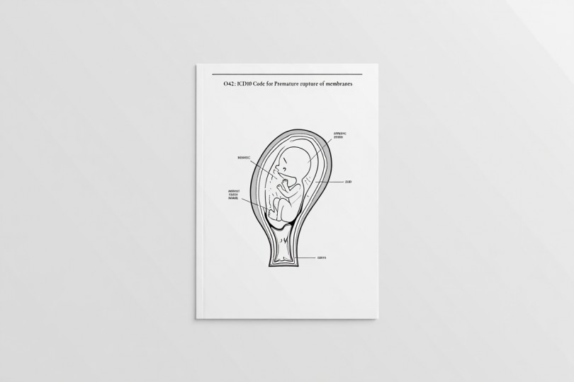 O42: ICD10 Code for Premature rupture of membranes
