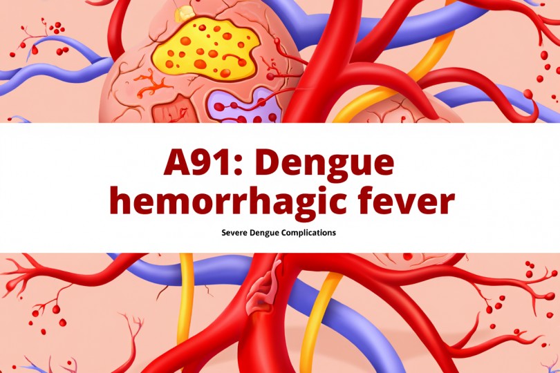 A91: Dengue hemorrhagic fever