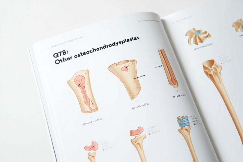 Q78: Other osteochondrodysplasias