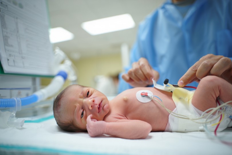 P01: Newborn affected by maternal complications of pregnancy
